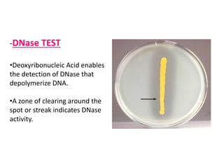 Staphylococcus aureus | PPTX