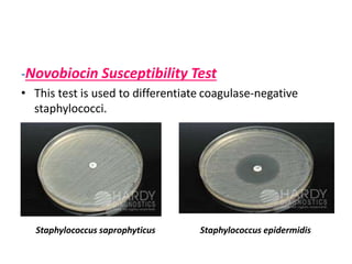 Staphylococcus aureus | PPTX
