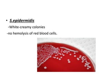 Staphylococcus aureus | PPTX