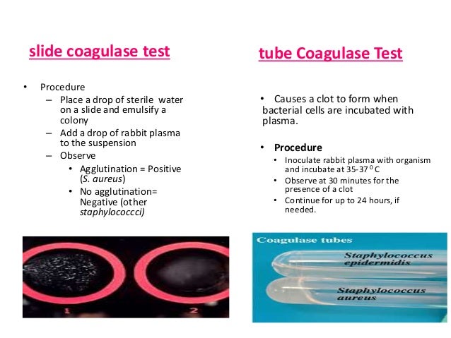 Staphylococcus aureus