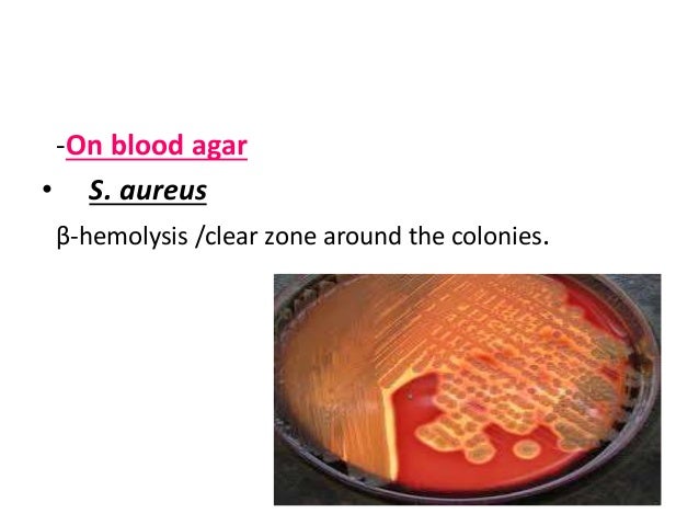 Staphylococcus aureus