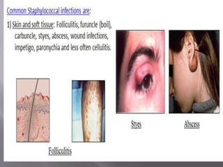 Staphylococcus bacteria | PPT