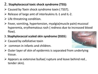 Staphylococcus | PDF