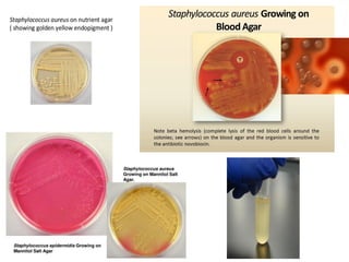 Staphylococcus | PDF