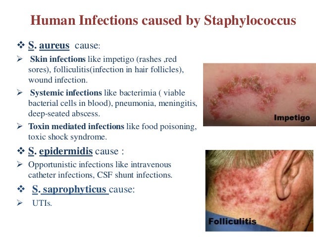 Staphylococcus