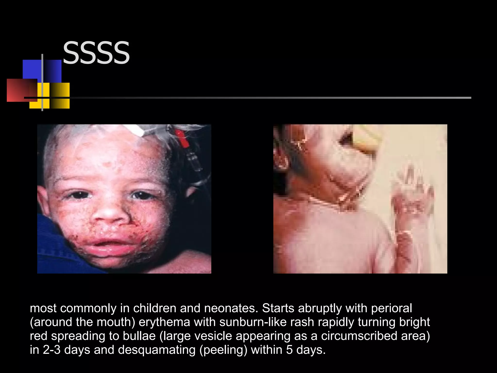 Staphylococcus (2) | PPT