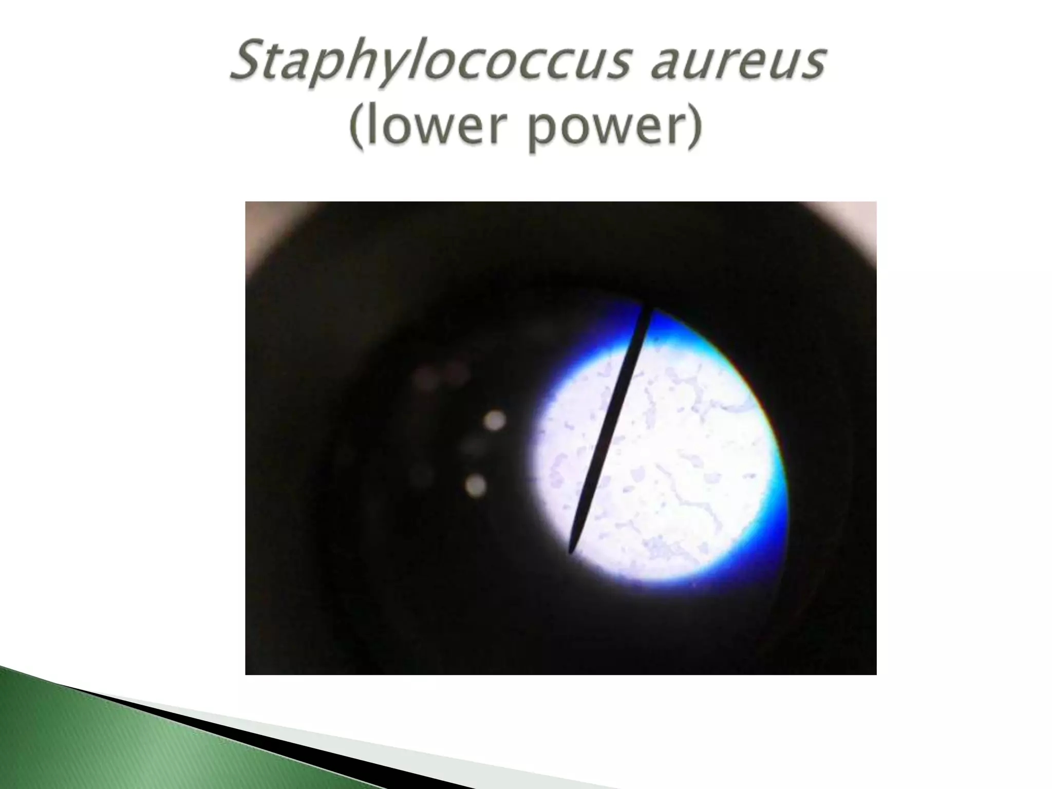 Staphylococcus aureus | PPTX | Medical Health