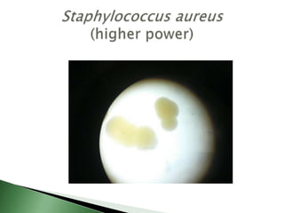 Staphylococcus aureus | PPTX