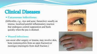 Staphylococcus aureus | PPTX | Infectious Diseases | Diseases and ...