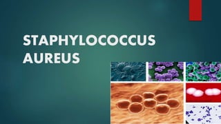 Staphylococcus aureus | PPT