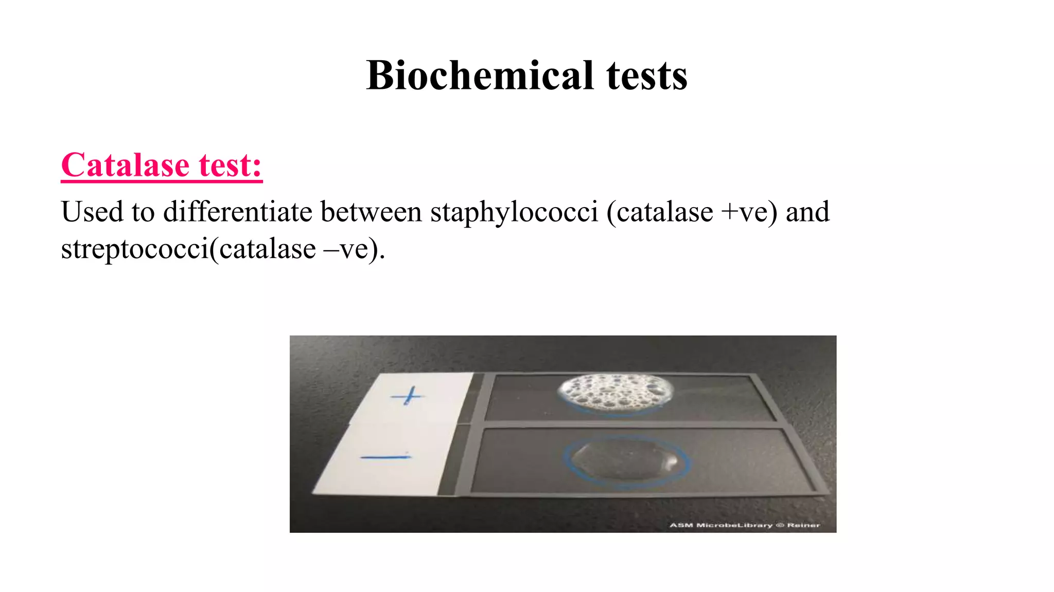 Diagnosis of Staphylococcus aureus (Updated ) | PPTX