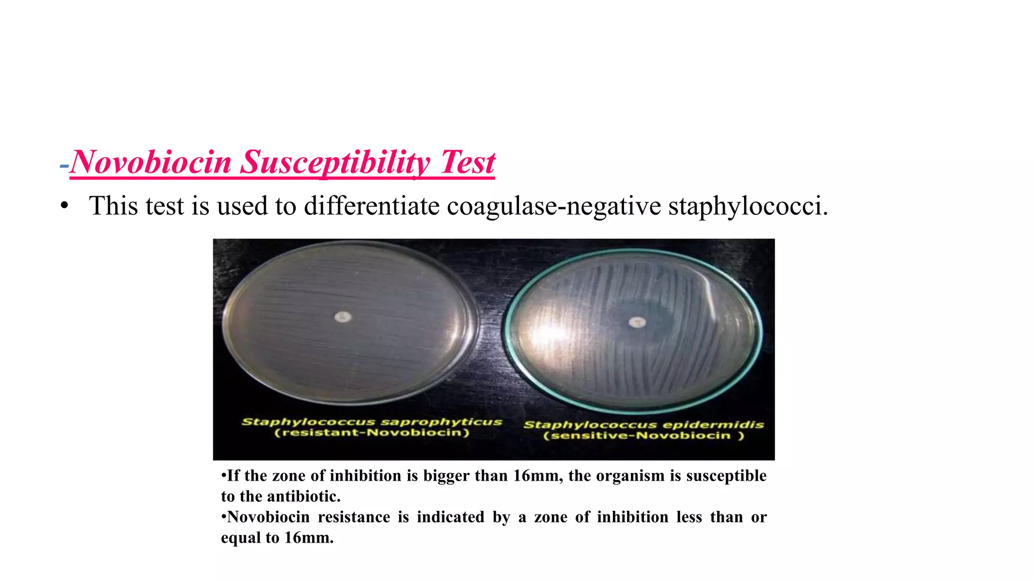 Diagnosis of Staphylococcus aureus (Updated ) | PPTX