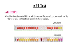Diagnosis of Staphylococcus aureus (Updated ) | PPTX
