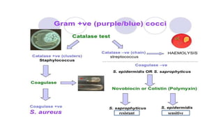 Diagnosis of Staphylococcus aureus (Updated ) | PPTX