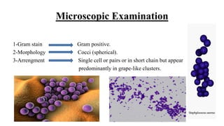 Diagnosis of Staphylococcus aureus (Updated ) | PPTX