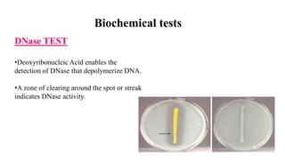 Diagnosis of Staphylococcus aureus (Updated ) | PPTX