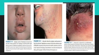 Staphylococcus Aureus Bacteria Microbiology Lecture | PPTX