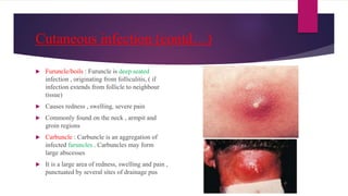 Staphylococcus aureus | PPTX
