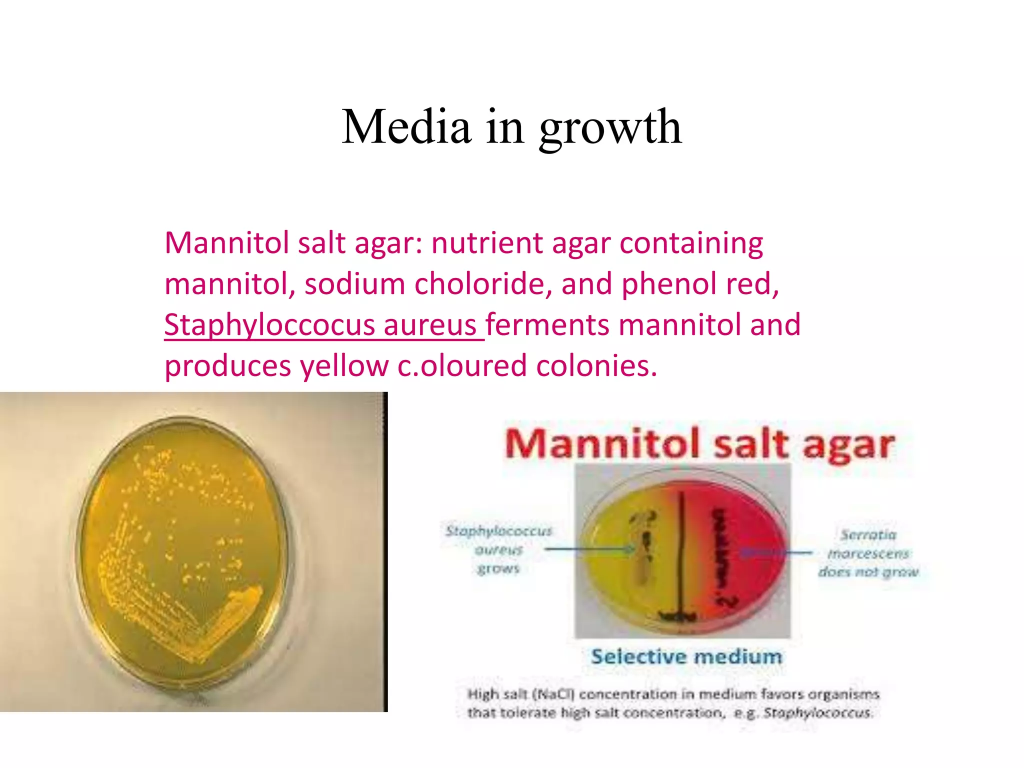 Staphylococcus aureus | PPTX