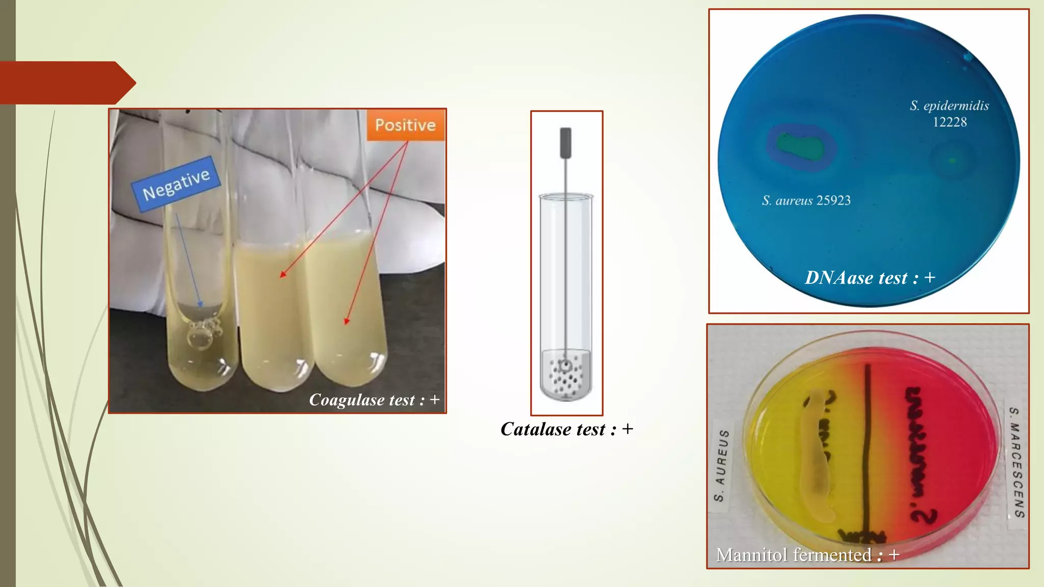 Staphylococcus Aureus | PDF