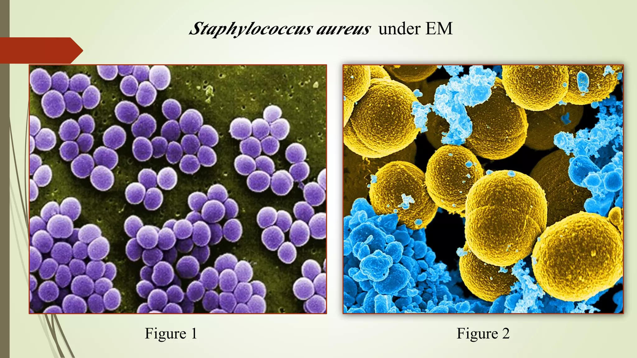 Staphylococcus Aureus | PDF