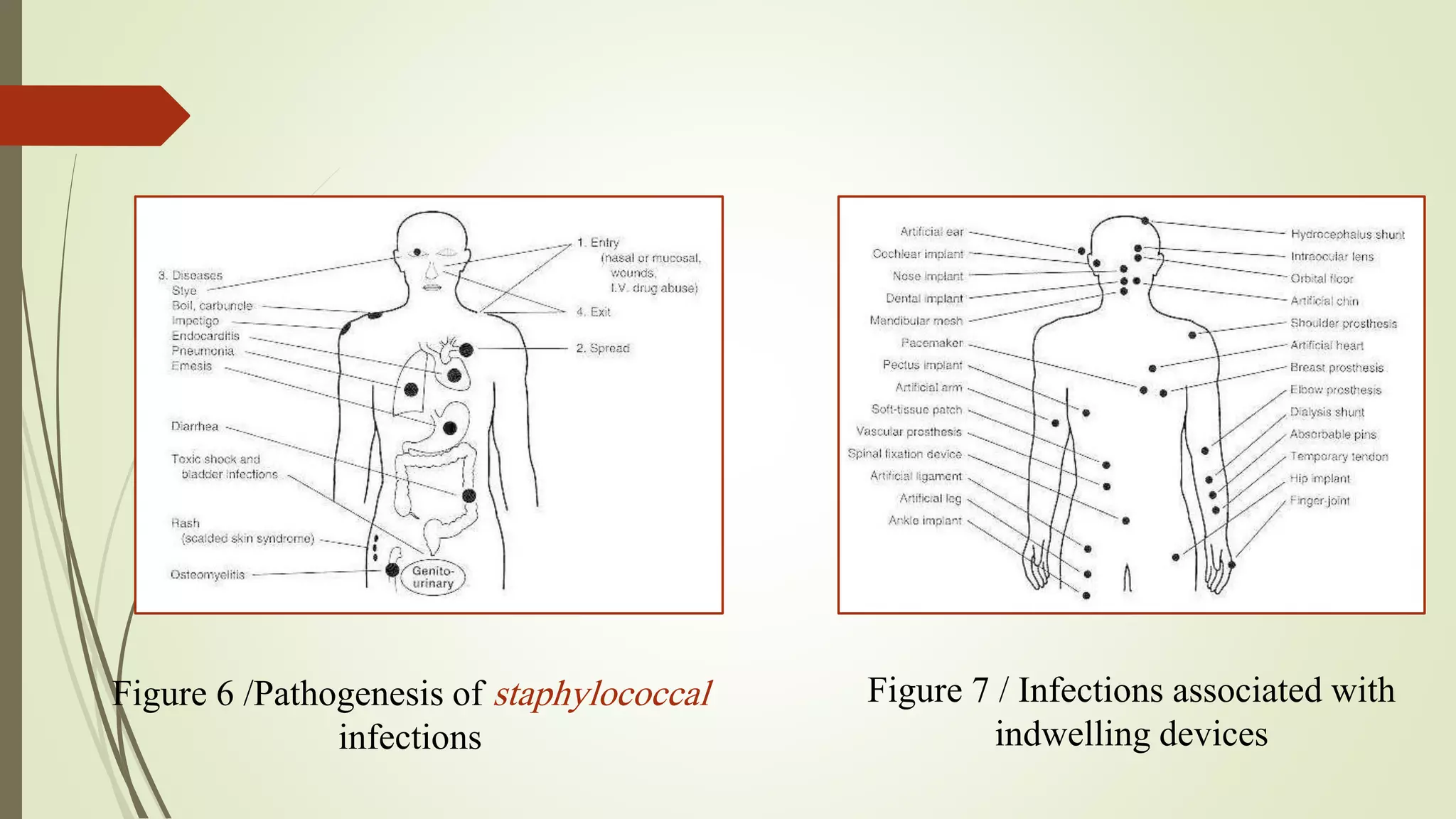 Staphylococcus Aureus | PDF