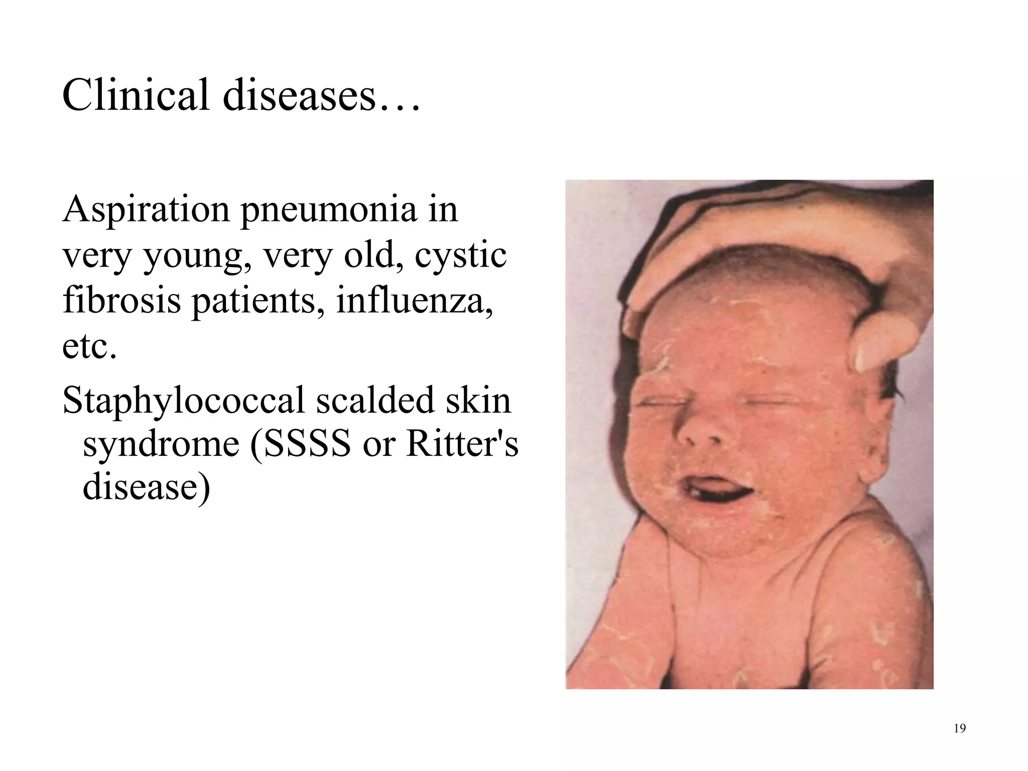 Staphylococcus aureus2013.ppt