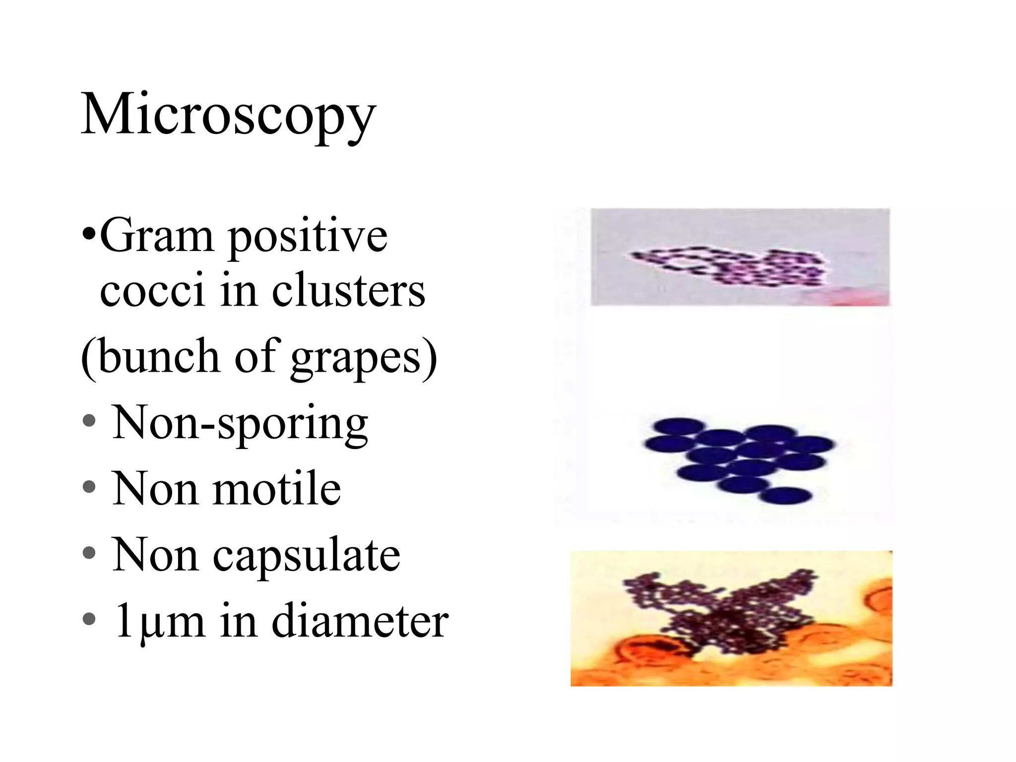 Staphylococcus aureus2013.ppt