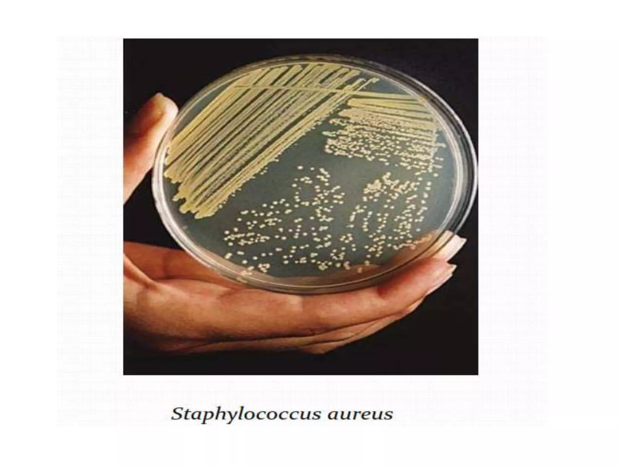 Staphylococcus aureus2013.ppt