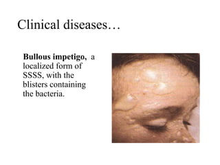 Staphylococcus aureus2013.ppt
