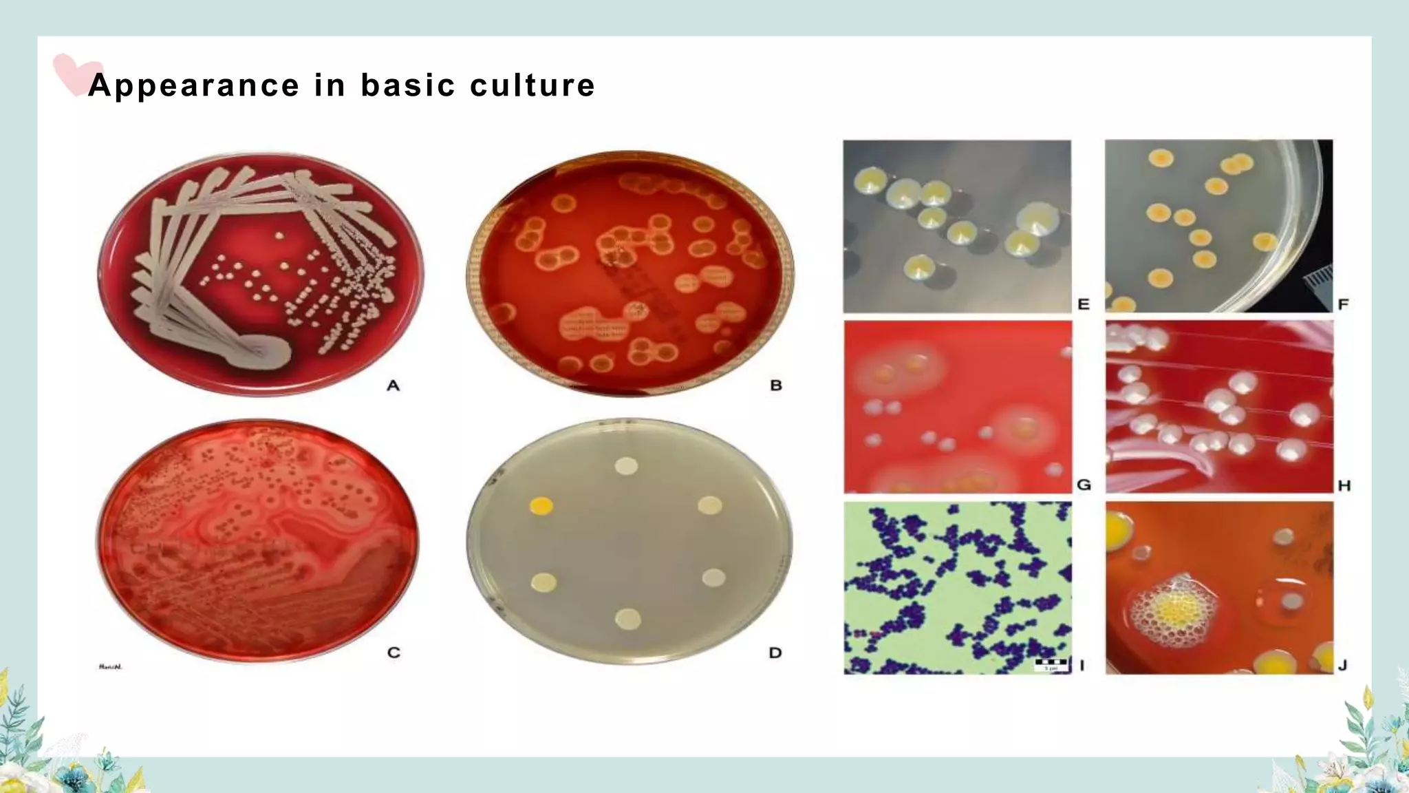 Staphylococcus aureus .pptx