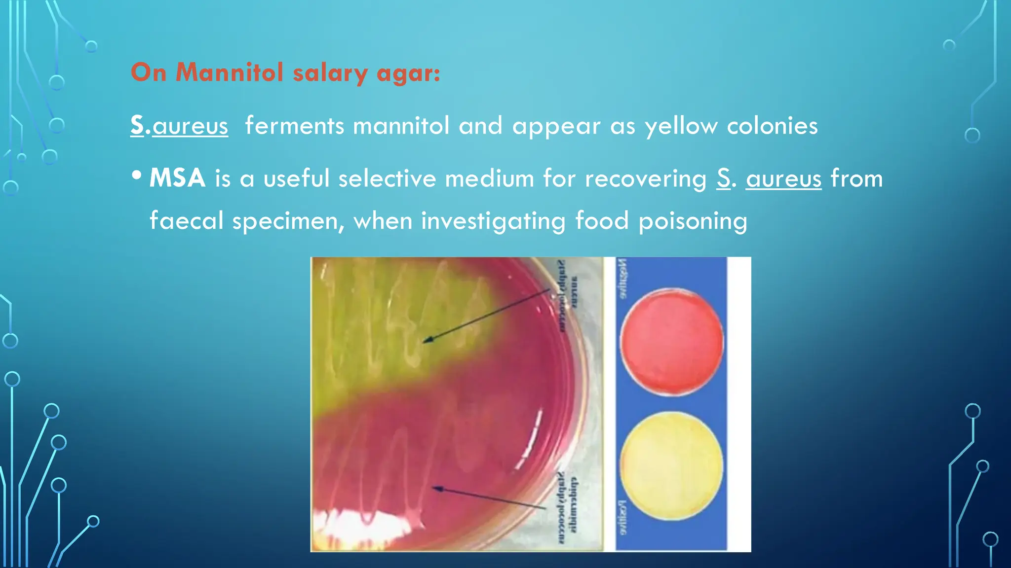 staphylococcus aureus from medical bacteriology | PPTX