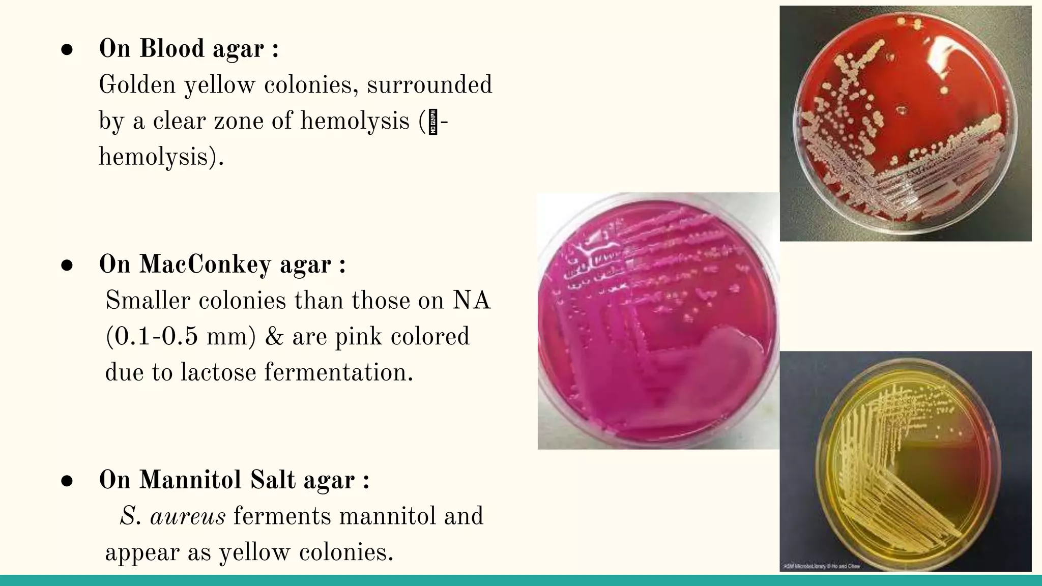 Staphylococcus aureus vanshika_varshney | PPTX