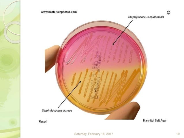 laboratory diagnosis of staphylococcus | PPTX | Infectious Diseases ...
