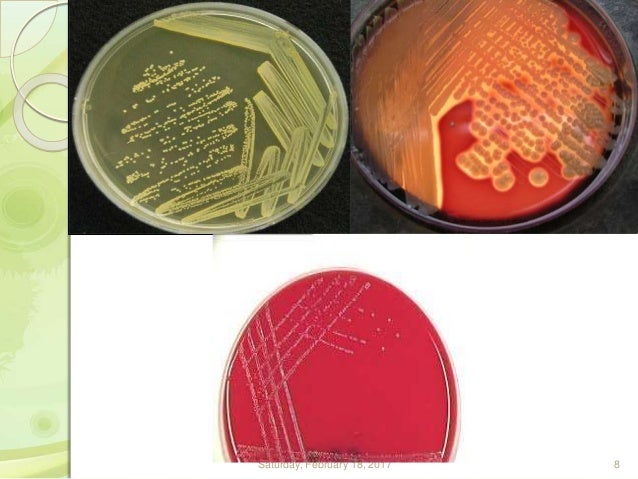 laboratory diagnosis of staphylococcus