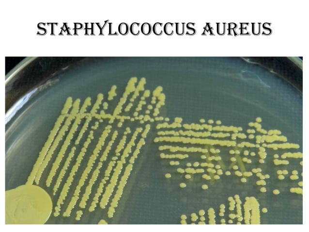 Staphylococcus | PDF