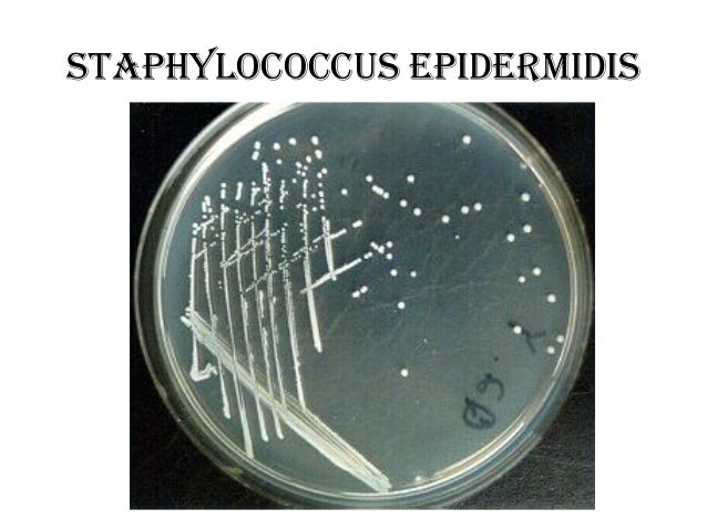 Staphylococcus