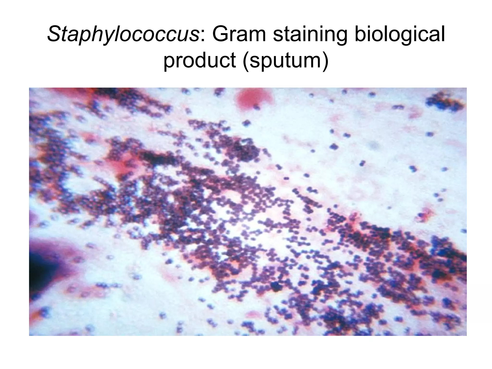 Staphylococcus streptococcus bacteriological diagnosis_i | PPT