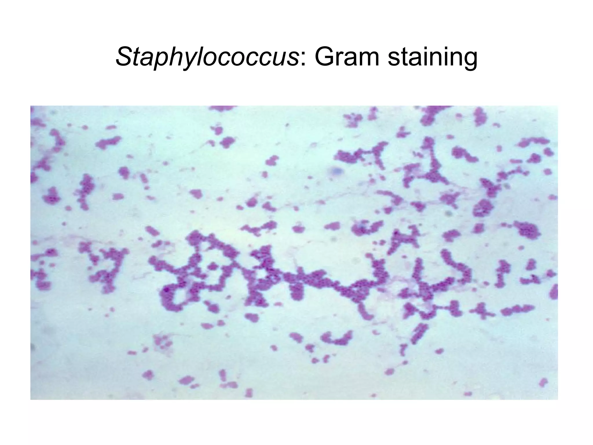Staphylococcus streptococcus bacteriological diagnosis_i | PPT