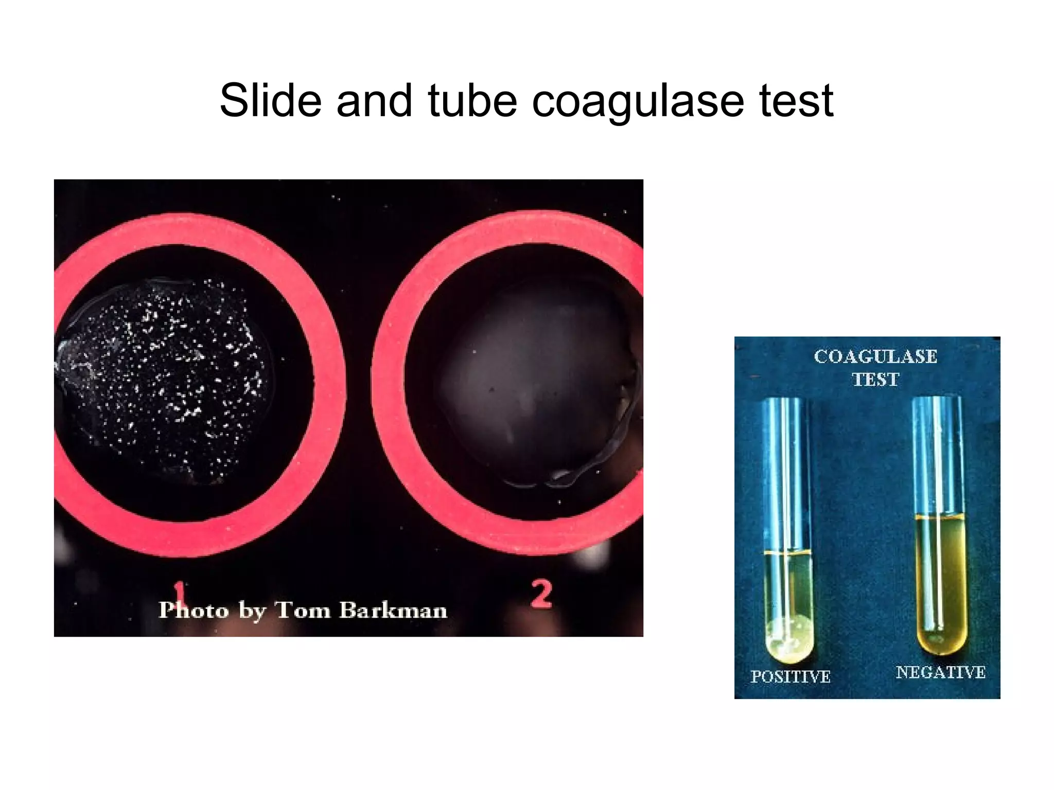 Staphylococcus streptococcus bacteriological diagnosis_i | PPT
