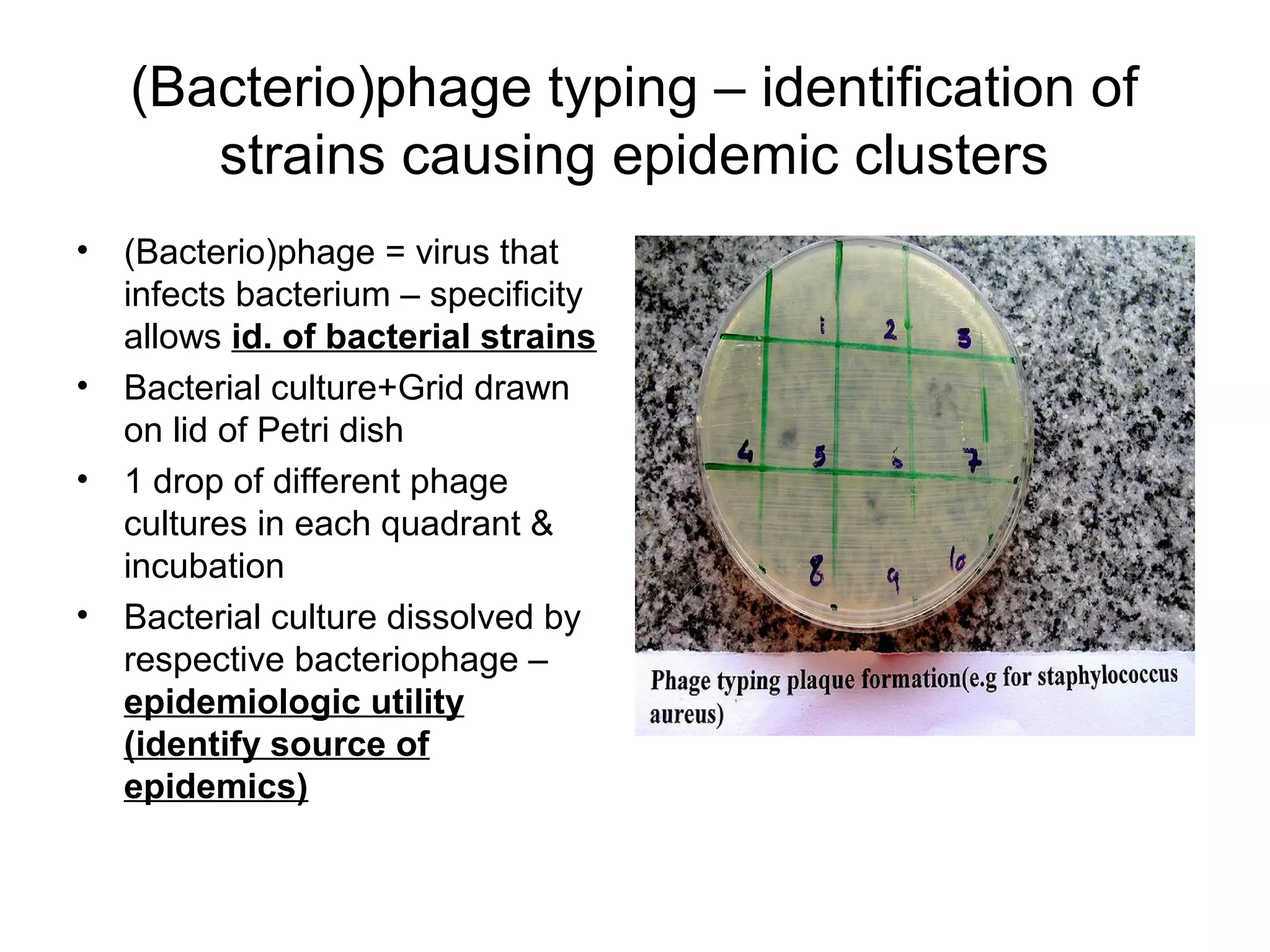 Staphylococcus streptococcus bacteriological diagnosis_i | PPT