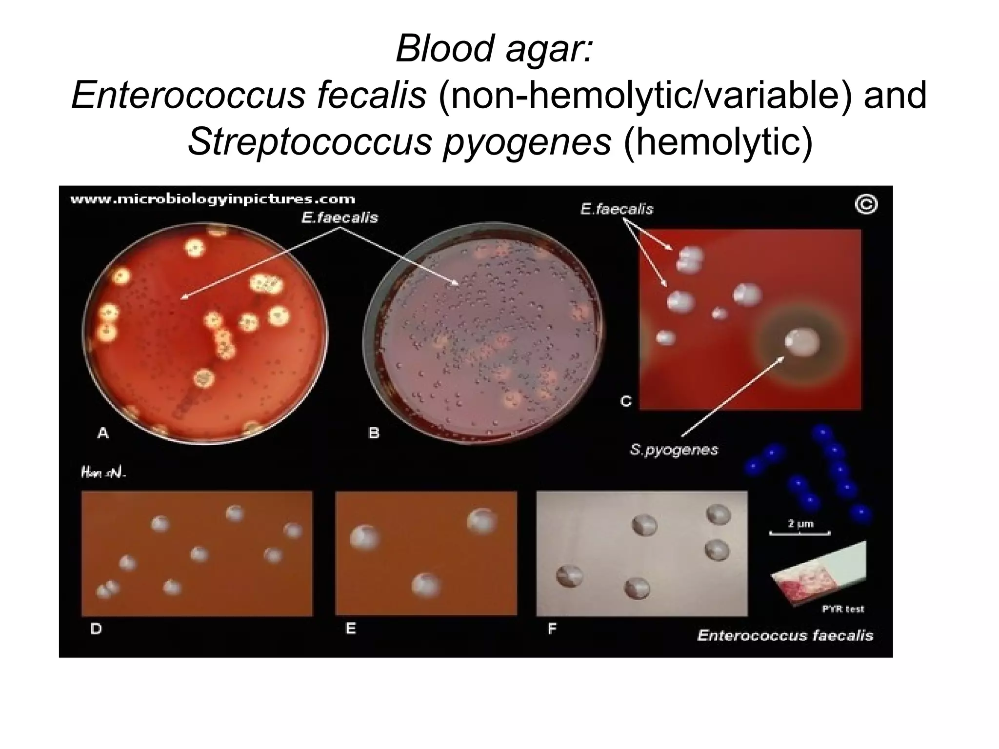 Staphylococcus streptococcus bacteriological diagnosis_i | PPT