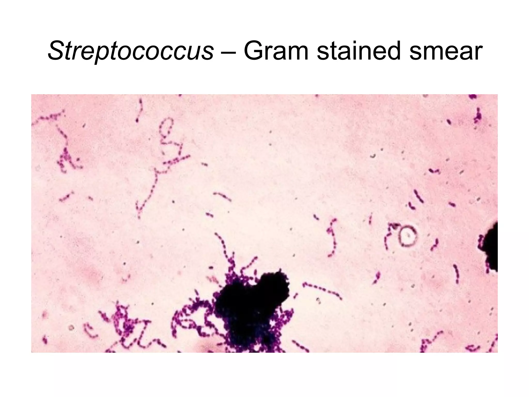 Staphylococcus streptococcus bacteriological diagnosis_i | PPT