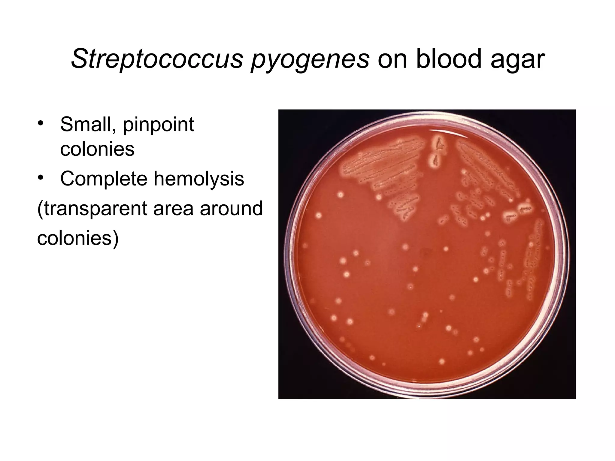Staphylococcus streptococcus bacteriological diagnosis_ii | PPT