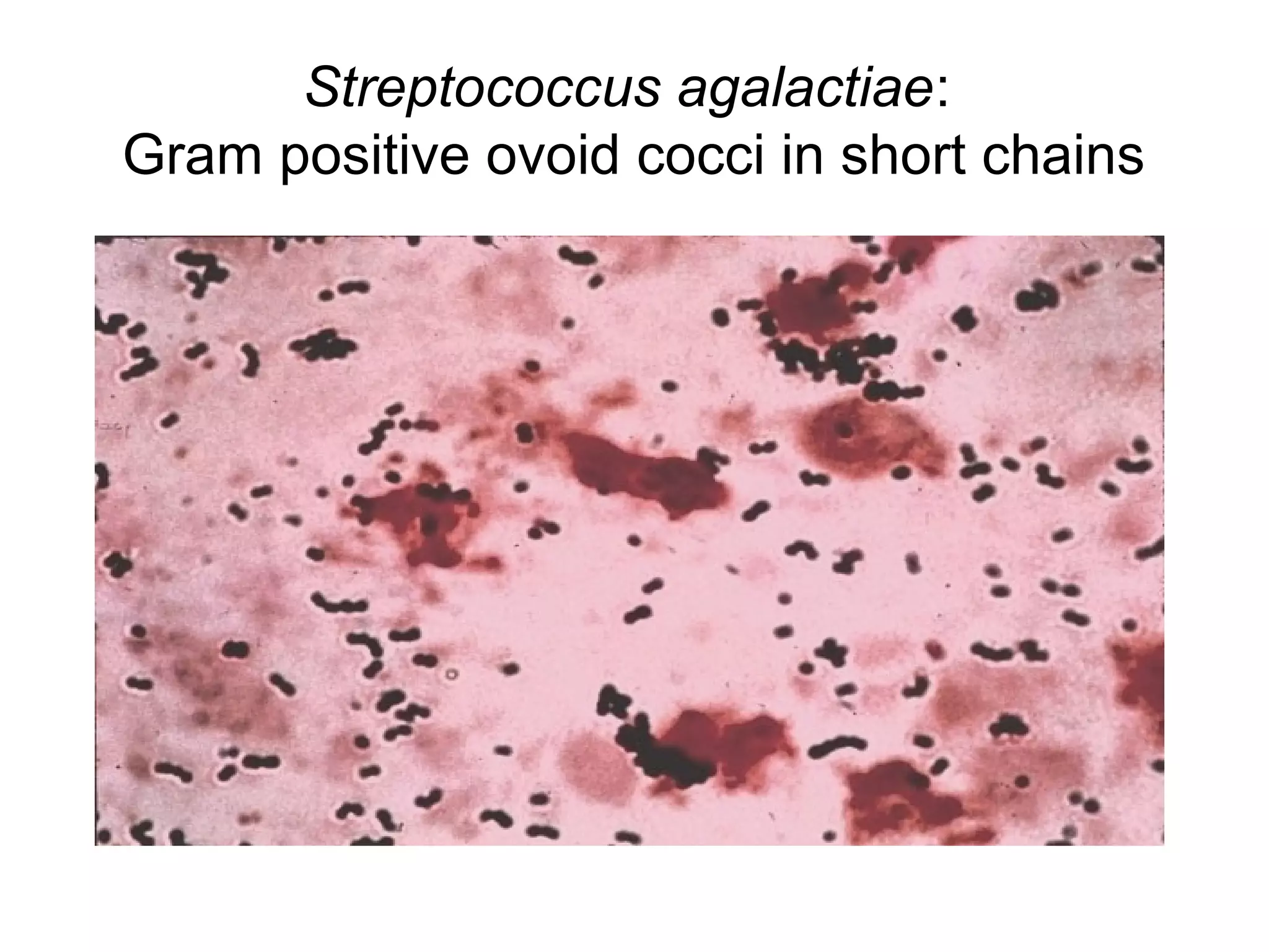 Staphylococcus Streptococcus Bacteriological Diagnosis Ii Ppt