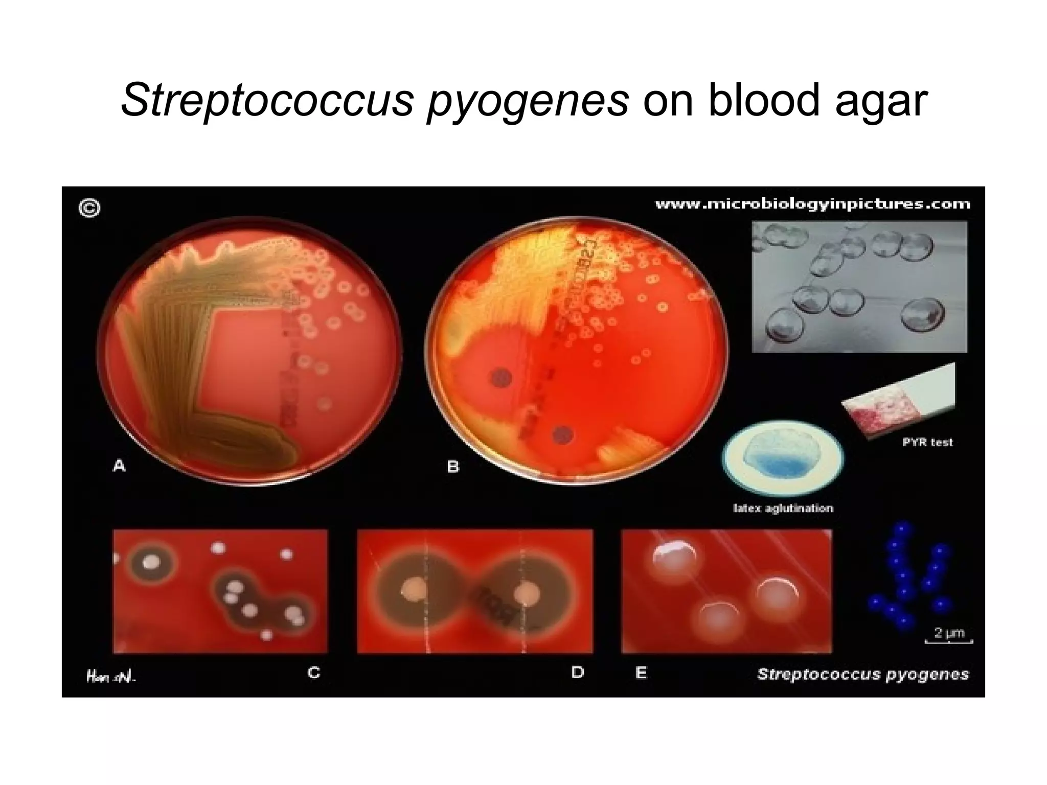 Staphylococcus streptococcus bacteriological diagnosis_ii | PPT