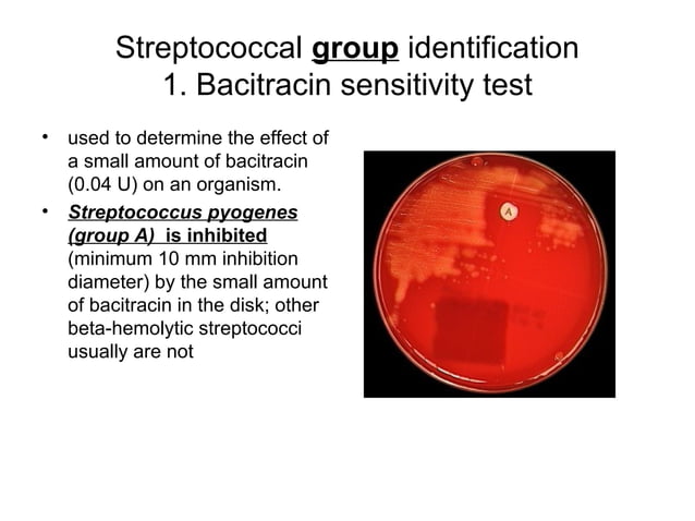 Staphylococcus streptococcus bacteriological diagnosis_ii | PPT