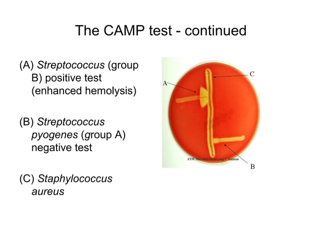 Staphylococcus streptococcus bacteriological diagnosis_ii | PPT