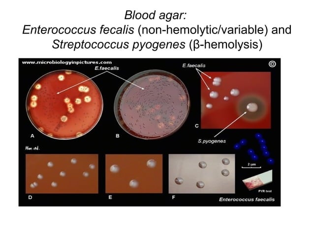 Staphylococcus streptococcus bacteriological diagnosis_ii | PPT