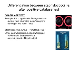 Staphylococcus streptococcus bacteriological diagnosis_ii | PPT